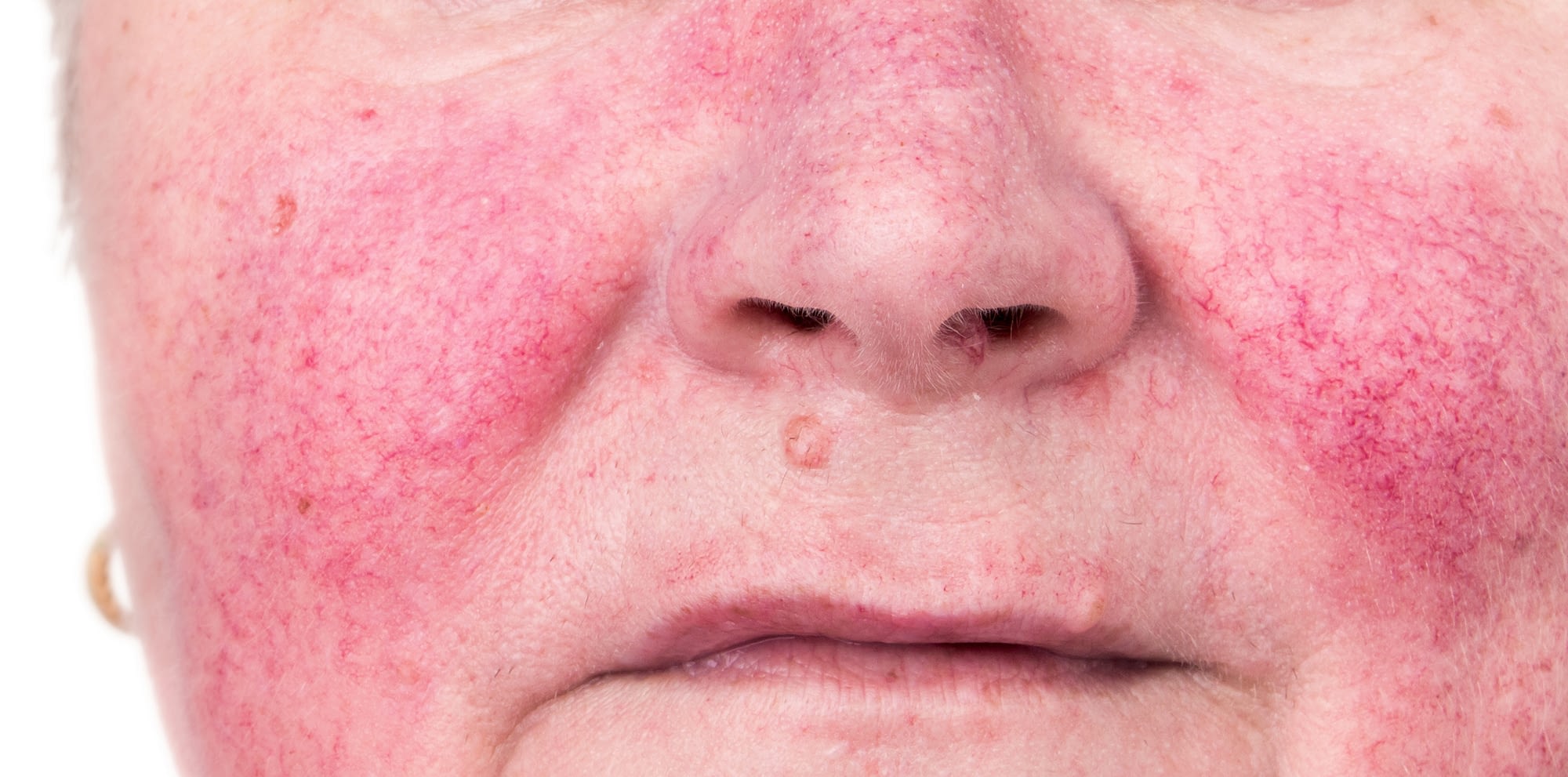 Conditions - Skin Clinics