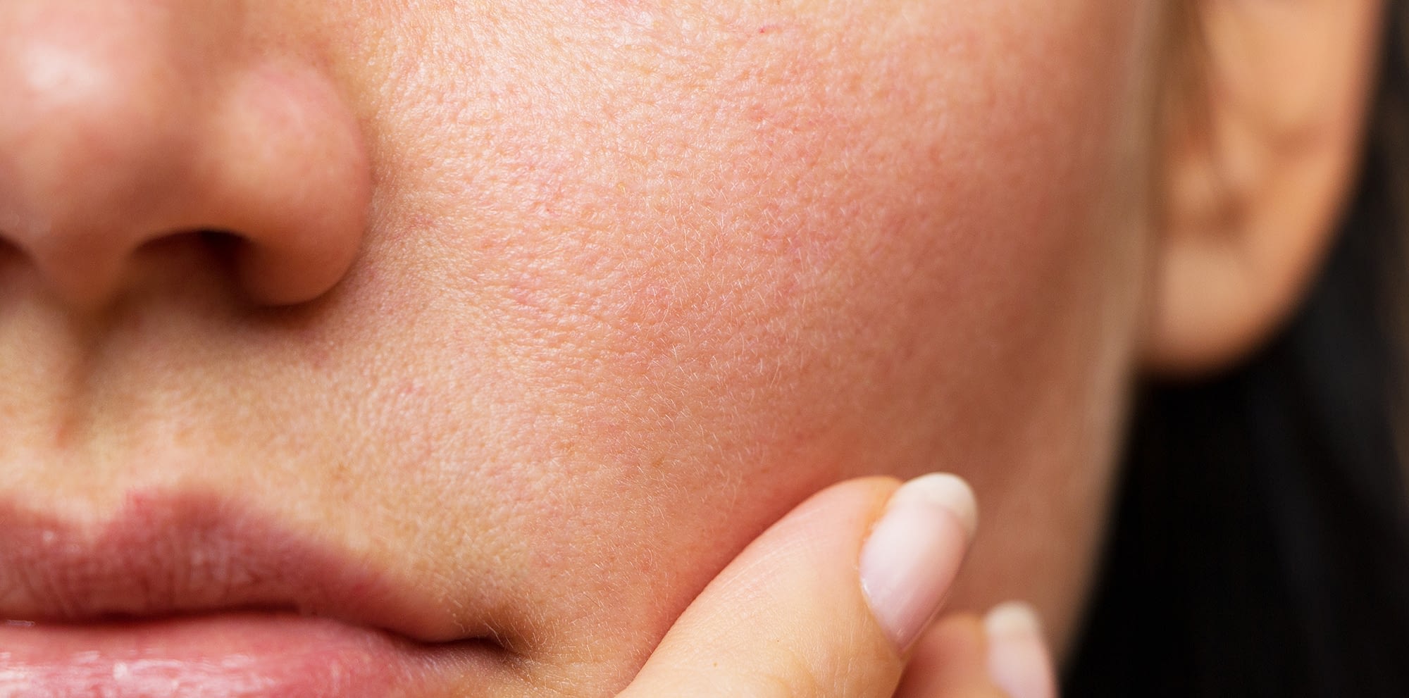 Conditions - Skin Clinics